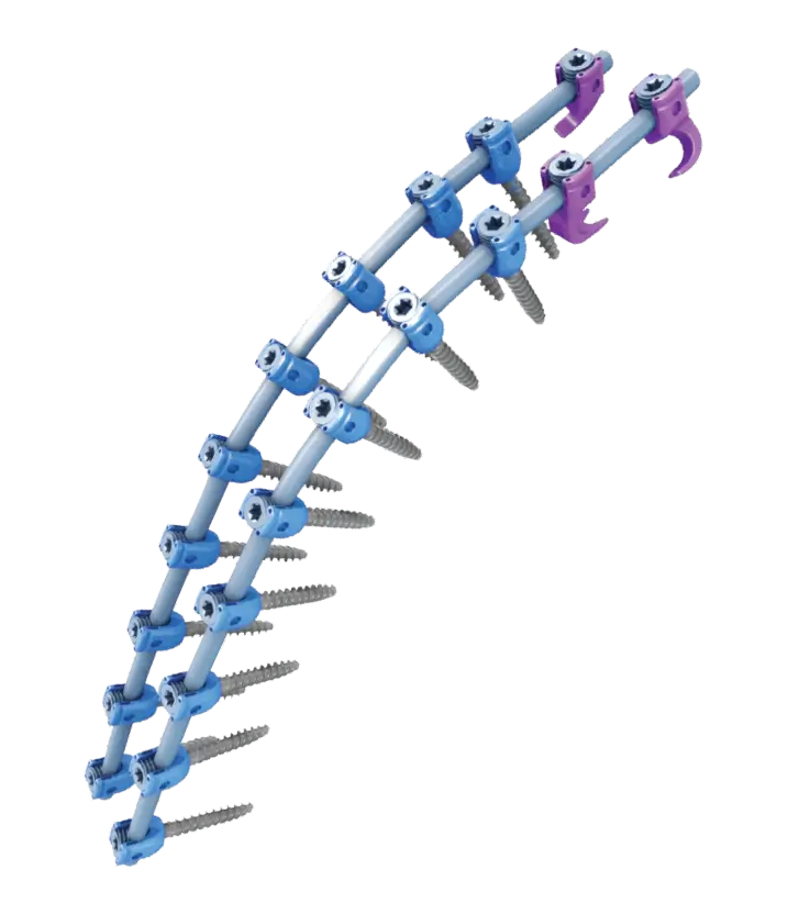 Vital™ Deformity Spinal Fixation System | Equinox Medical